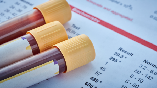 10 most important blood tests everyone should get regularly | - Times ...