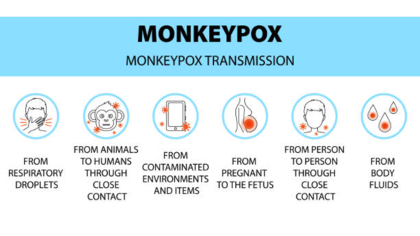 Monkeypox preparedness in India: 13 big questions answered here | - Times of India