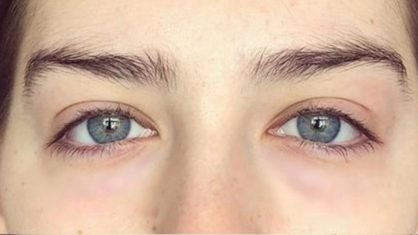 Eyes hold the key to one's personality: Here's what different eye ...