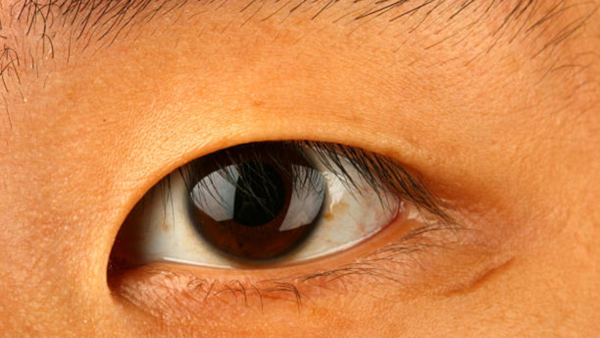 Eyes hold the key to one's personality: Here's what different eye ...