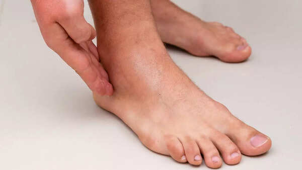 Bad Cholesterol Signs: Surprising signs of bad cholesterol are seen in ...