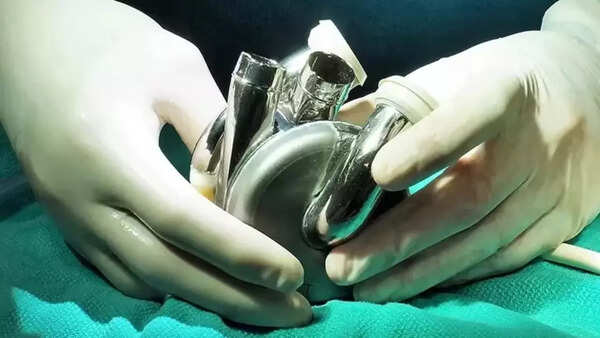 Australian man receives world's first artificial heart: New hope for ...