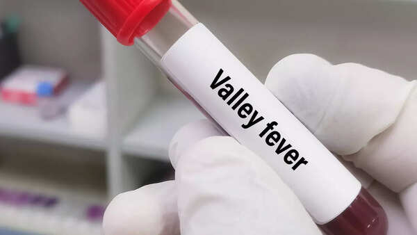 Valley fever turning into an endemic in California: Scientists find a ...