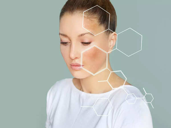 Iron deficiency symptoms: 5 common signs of iron deficiency you shouldn ...
