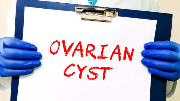 Hailey Bieber reveals she has ovarian cysts: What is it? Know the symptoms | - The Times of India