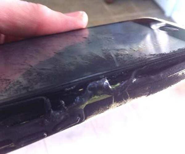 iPhone catches fire in teenager’s pocket - Times of India