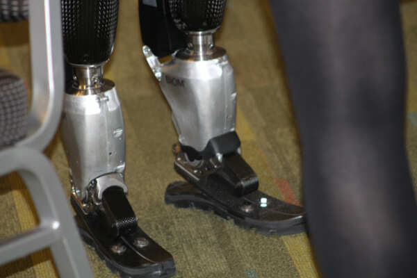 Bionic, baby, bionic: Boston bombing amputee dances again - Times of India