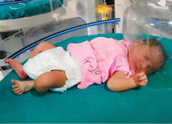 India’s 11% of neonatal deaths happen in Bihar | India News - Times of ...