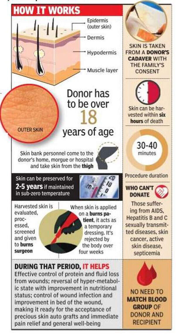 Karnataka gets its first skin bank | India News - Times of India