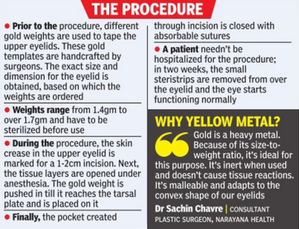 Gold weights on eyelids help cure facial deformity | Bengaluru News ...