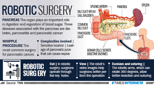 Infographic: ROBOTIC SURGERY - Times of India