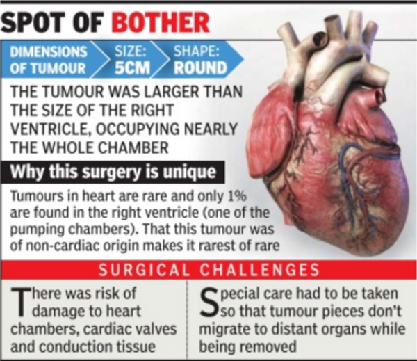 Heart-stopping surgery saves life | Delhi News - Times of India