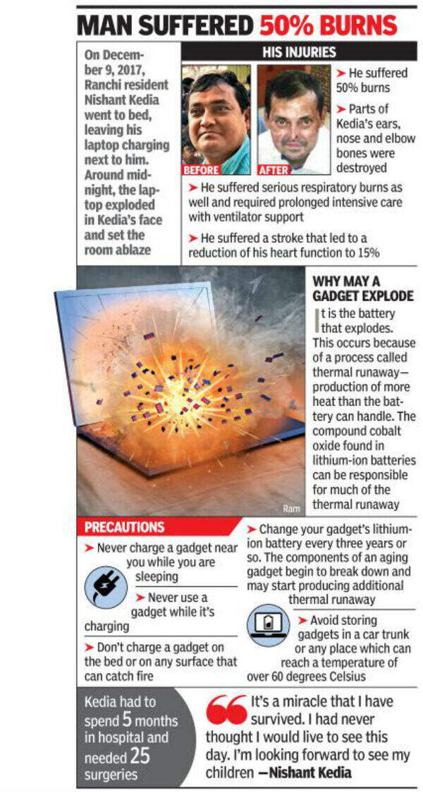 Laptop charging on bed explodes in user’s face | Mumbai News - The ...