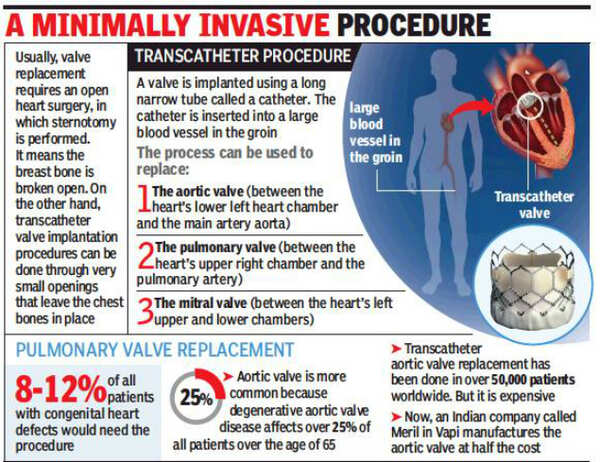 Doctors Repair Heart: Mumbai: Doctors repair heart by inserting tools ...