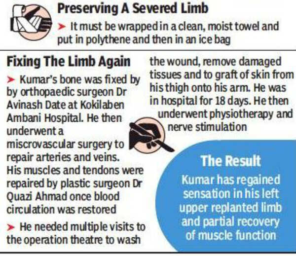 Teen’s reattached arm regains sensation 1 year after surgery | Mumbai ...
