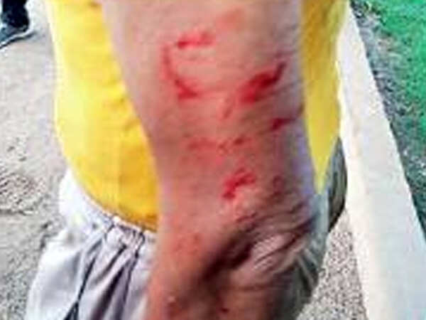 Wild boar pounces on walker at deer park | Hyderabad News - Times of India