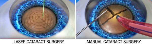 Smart Technology at Smart Vision Eye Hospitals - Times of India