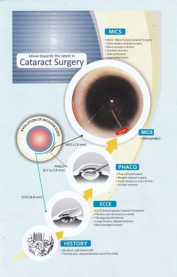Smart Technology at Smart Vision Eye Hospitals - Times of India