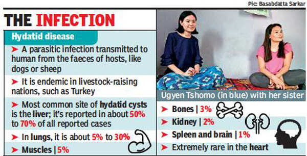 Kolkata doctors save Bhutan teen with rare heart disease caused by ...