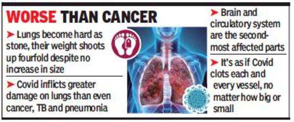 Covid turns lungs as hard as stone: Autopsy | Ahmedabad News - Times of ...