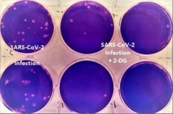 DCGI approves anti-Covid drug developed by DRDO for emergency use ...