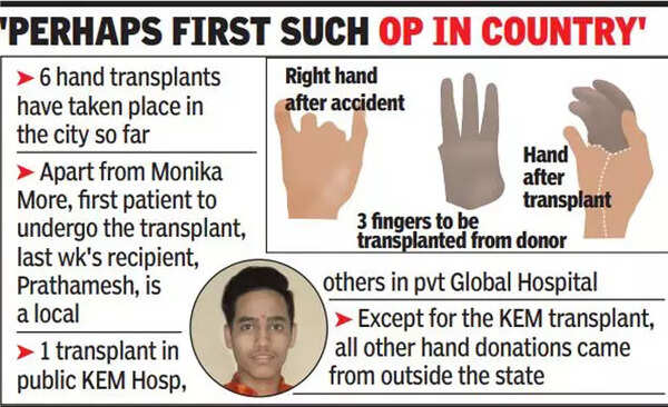City’s 6th Hand Transplant Patient Moves Fingers In Wk | Mumbai News ...