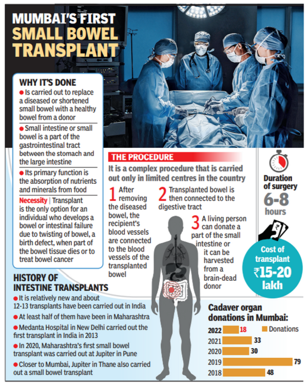 Small Bowel Transplants Rare, Focus On Cadaver Donations | Mumbai News ...