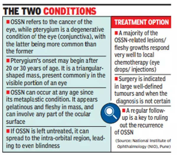 Growth In Eye? Check On Time To Rule Out Cancer | Pune News - Times of ...