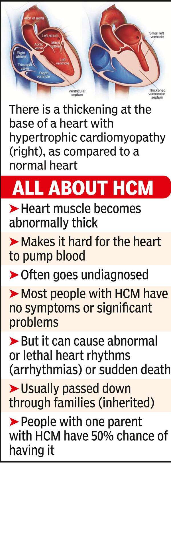 Woman Defeats Rare Heart Disease Which Claimed 3 Of Her Kin | - Times ...