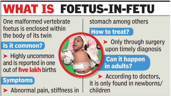 Foetuses Case in Ranchi: In a first, Ranchi hospital doctor finds 8 ...