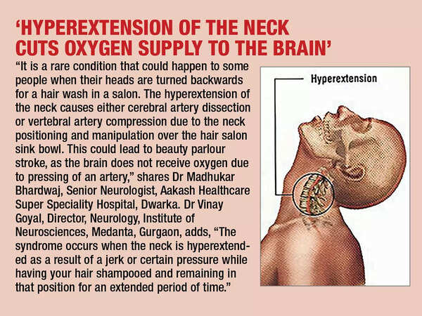 Explained: Beauty parlour stroke syndrome - Times of India