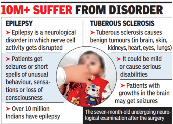 Only 2 of 1,000 epilepsy patients in India opt for life-altering ...