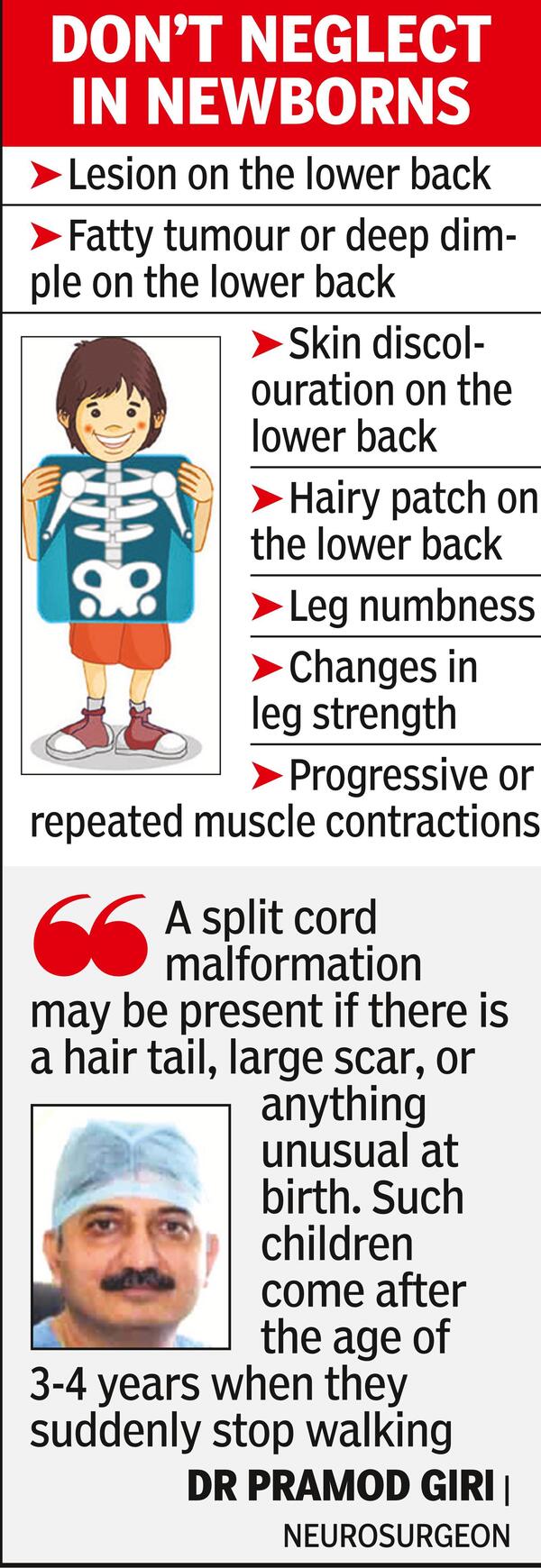 3-year-old Saved From Rare Defect That Splits Spinal Cord | - Times of ...