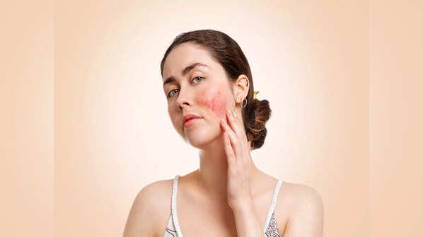 Mpox cases spike: After COVID-19, China is now facing an Mpox crisis