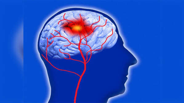 A mutiny against the brain
