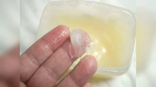 Skin chafing during monsoon: Tips to avoid chafing and how to recover ...