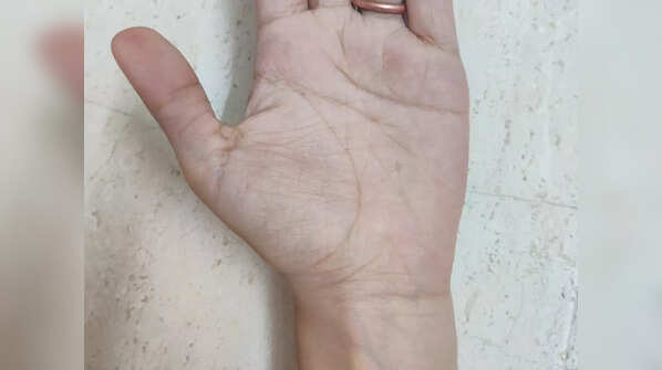 The lines on your wrist or ‘bracelet lines’ mean this for your life