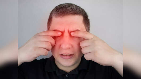 Eye Flu: 8 home remedies that can help prevent eye flu in monsoon