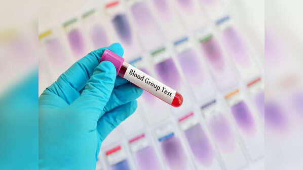 Stroke Risk Factor: Your blood type may predict your risk of having a ...