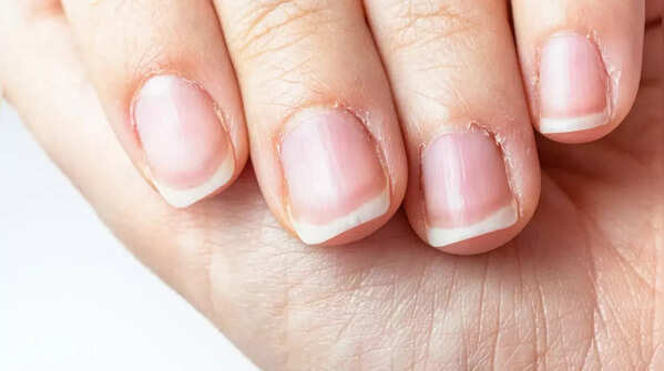 Skin Cancer Symptoms: NOT just rashes: Common signs of skin cancer you ...