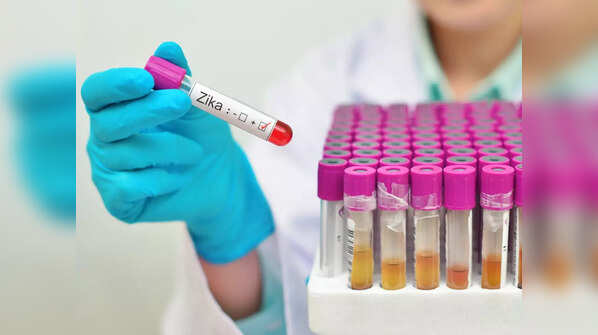 Difference between Zika virus, dengue and chikungunya explained