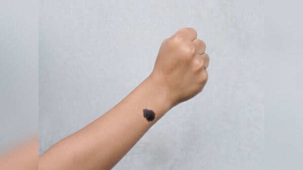 What having birthmark on these parts of your body really means