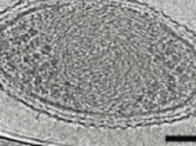 Scientists capture detailed microscopy evidence of smallest-ever bacteria