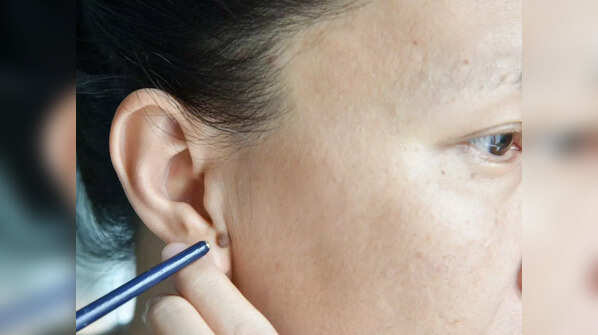 Revealed! What your birthmark conveys about your personality