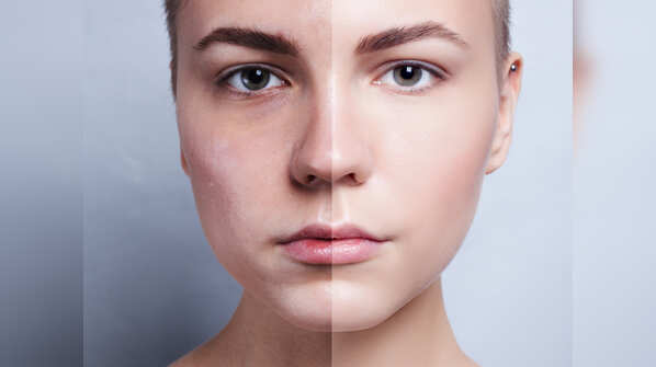 Benefits of Quitting Alcohol on Skin: I QUIT alcohol for a month and ...