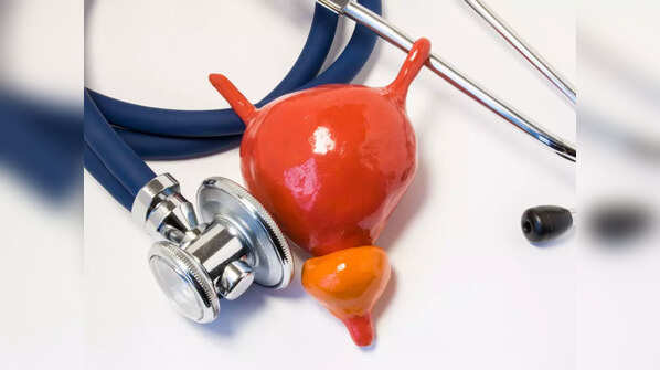 Common prostate problems men should watch out for