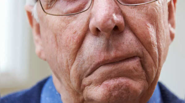 How do I know if I am having a stroke? 3 unmissable symptoms