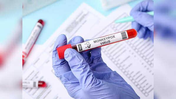 Monkeypox Symptoms: Study finds two symptoms of Monkeypox that could ...