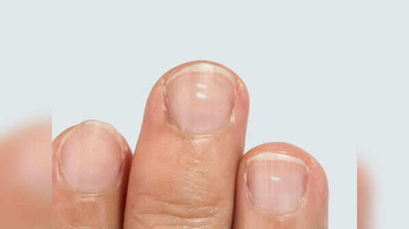 Here’s what happens when you stop having milk