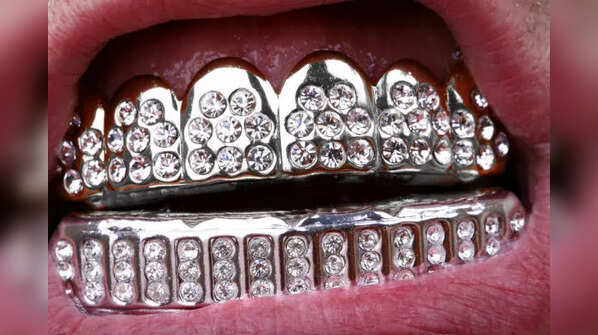 Want to flaunt tooth gems like Lisa from BLACKPINK? Here's all you ...